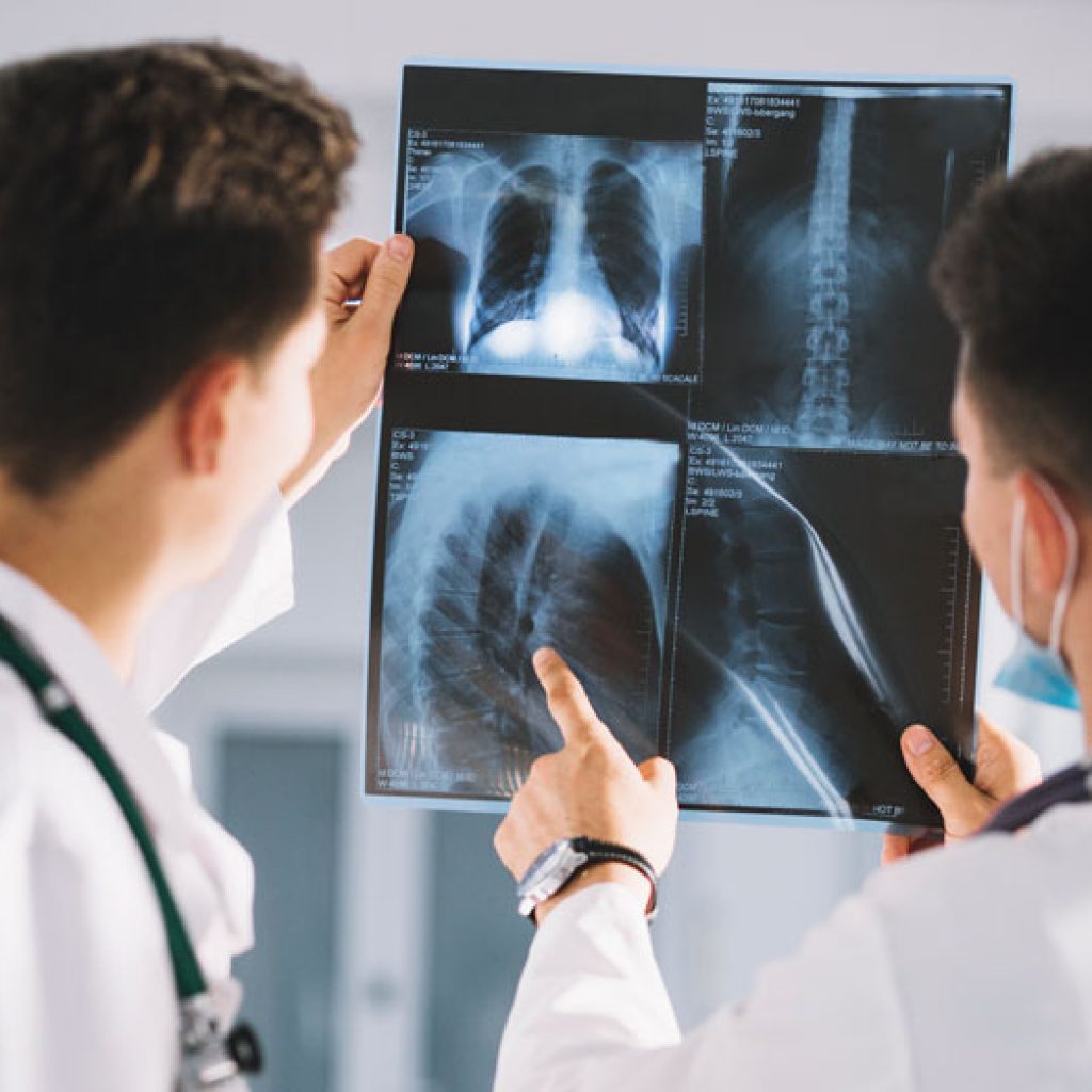 rayos-x-interna - Clinica Santa Teresa